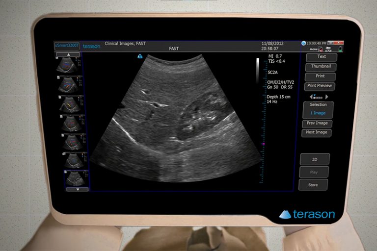 Ultrasonidos – Prhoinsa